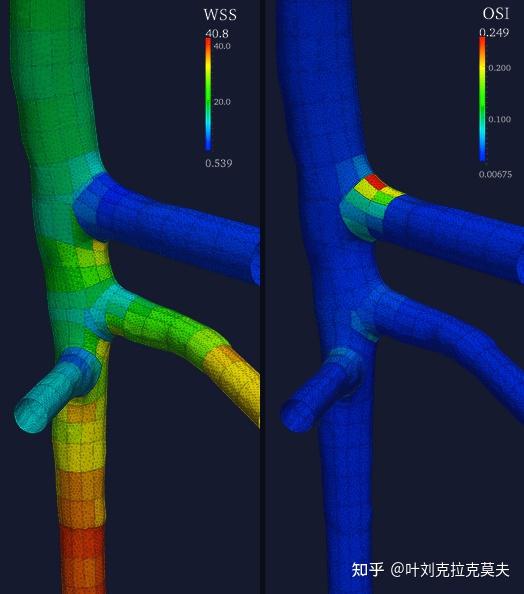 开源科学工程技术软件介绍60 – 血管建模软件VMTK - 知乎