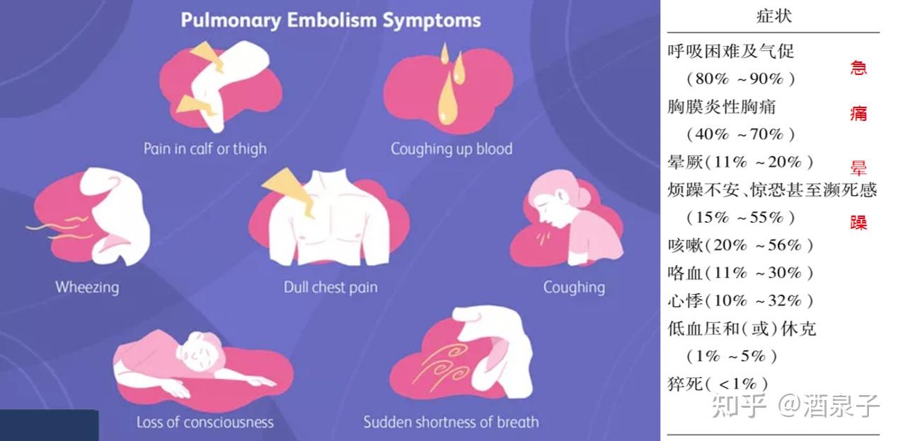 VTE、DVT与PE的关系 - 知乎