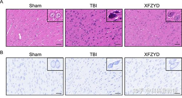 不会吧！还不知道tsRNA测序也能预测中药治疗疾病的靶点？一文带你了解一下 - 知乎