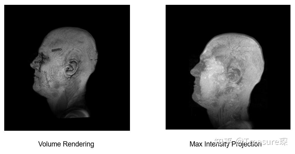 MATLAB科研图像处理——图像堆栈Z projection - 知乎