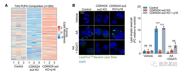 Can Cell | CDKN2A基因缺失重塑脂质代谢，诱发胶质母细胞瘤铁死亡 - 知乎