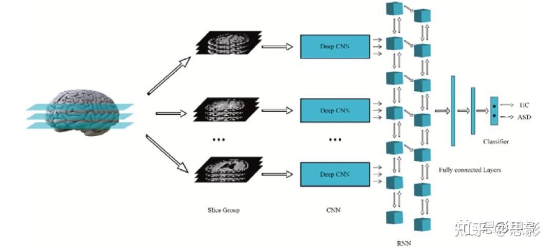 深度学习在自闭症谱系障碍神经成像诊断和康复中的应用 - 知乎