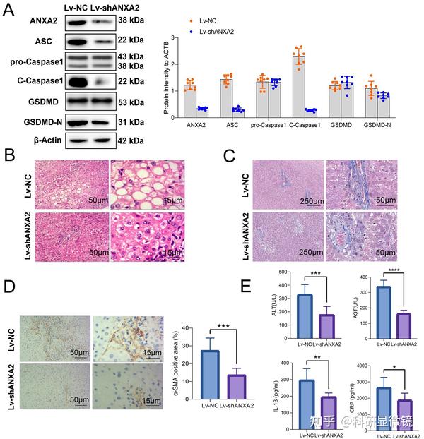 紧跟国自然热点，8+SCI文献教你如何设计非肿瘤细胞焦亡思路 - 知乎