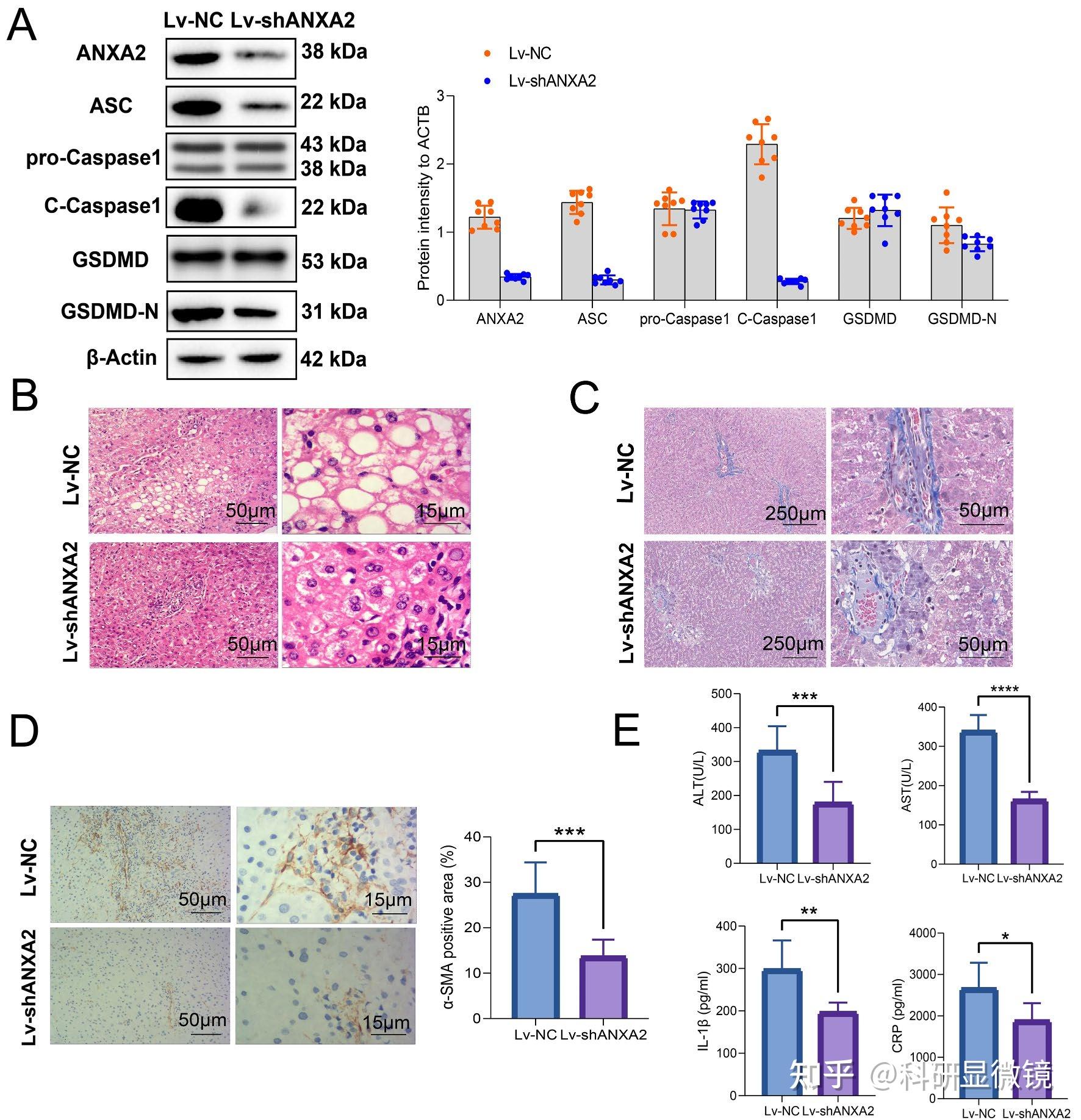 紧跟国自然热点，8+SCI文献教你如何设计非肿瘤细胞焦亡思路 - 知乎