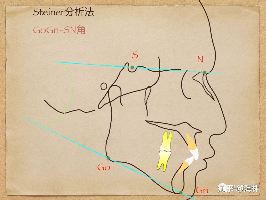 关于高角低角，看这一篇就够了----头影测量 - 知乎