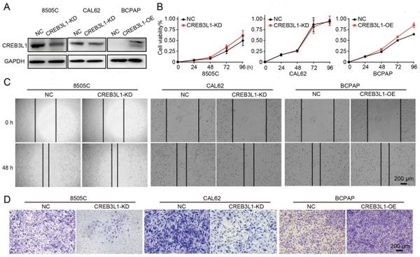 【IF=41】单细胞技术揭秘CREB3L1促进间变性甲状腺癌的生长和转移 - 知乎