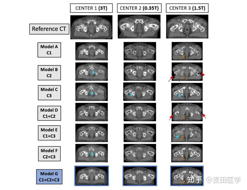 文献速递：生成对抗网络医学影像中的应用——用于生成前列腺MR-only影像治疗剂量规划的合成CT的深度学习模型：多中心研究 - 知乎