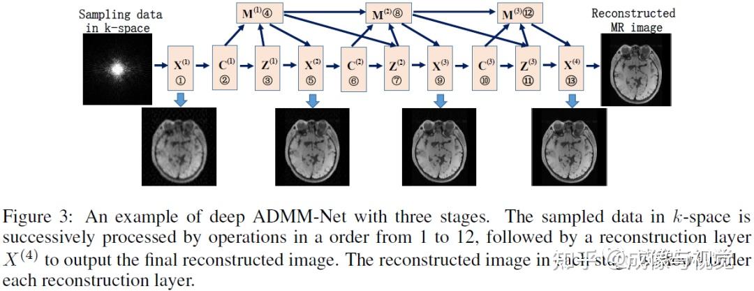 基于模型驱动的深度展开框架1—磁共振成像与自然图像压缩感知分析（ADMM-CSNet） - 知乎