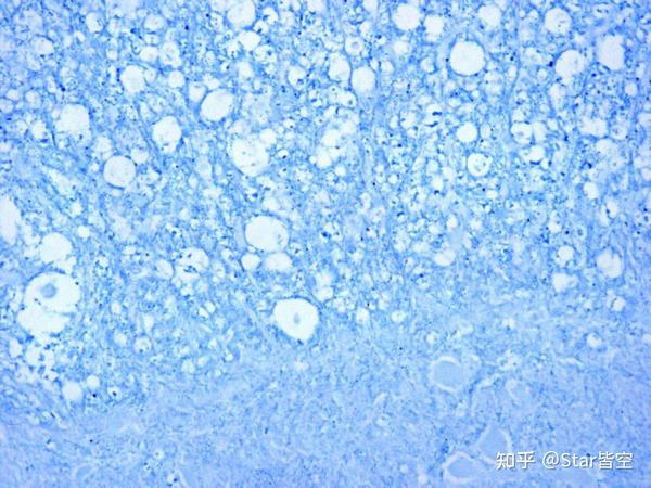 快速掌握一种染色实验方法——LFB髓鞘染色法！ - 知乎