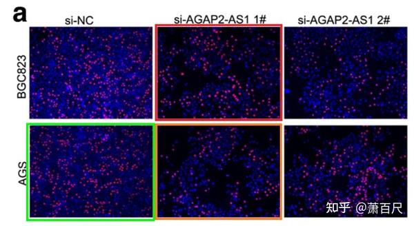 南京医科大学等多单位发表的1区论文被质疑数据存在重复发表 - 知乎
