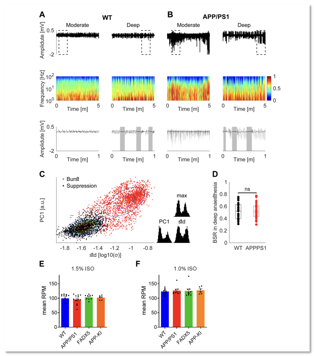 睡眠分析 | Lunion Stage® 功能更新：增加爆发抑制率指标计算功能 - 知乎