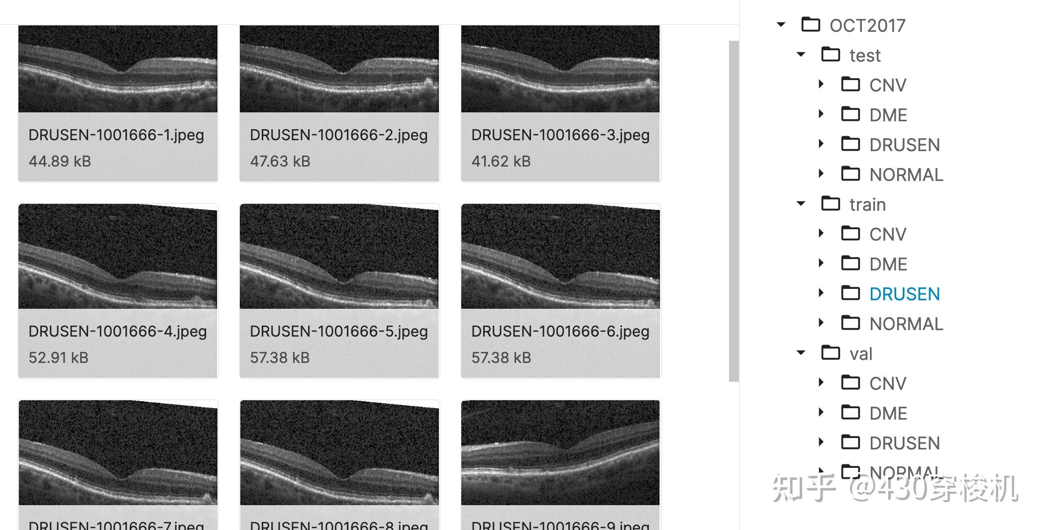 深度学习与医疗影像 —— 数据集整理 - 知乎