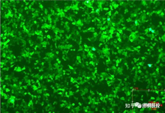 细胞实验专栏 | 新手必看：慢病毒感染全攻略（上） - 知乎