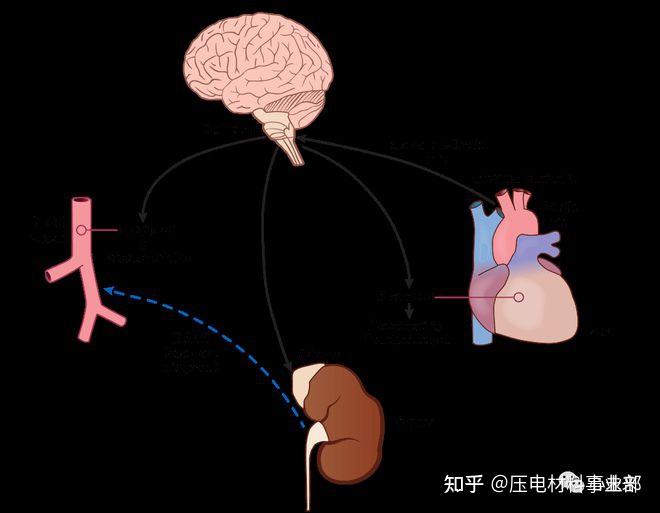 超声肾去神经（RDN）压电陶瓷圆管-超声消融导管 - 知乎