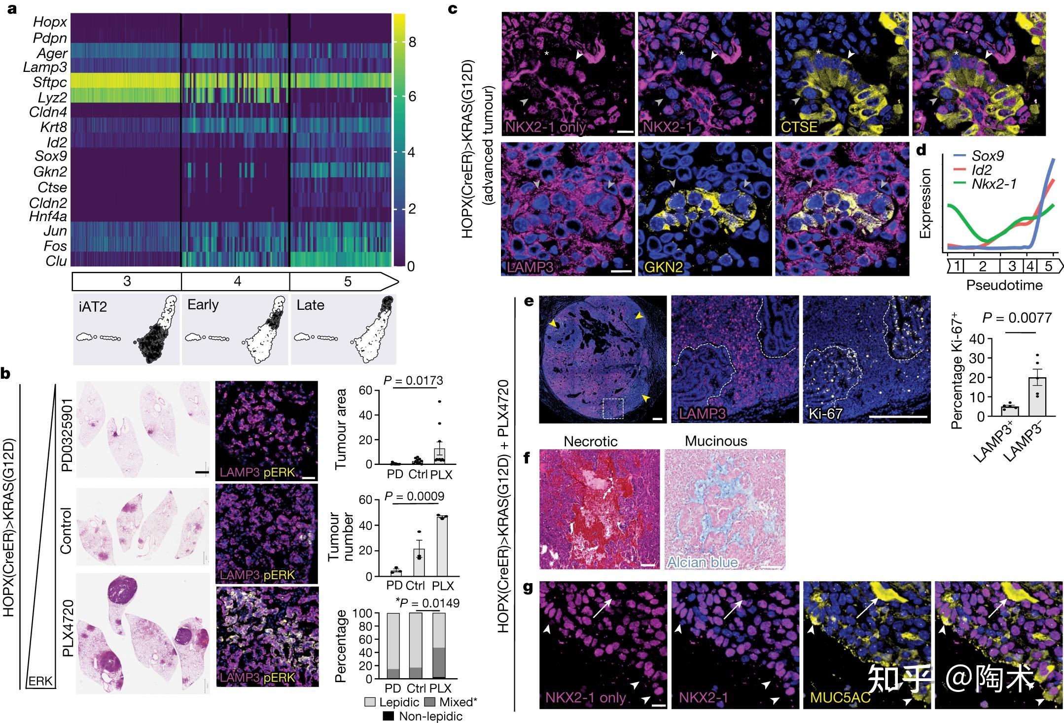 Nature重磅！揭秘KRAS（G12D）驱动鳞状肺腺癌新机制！！ - 知乎