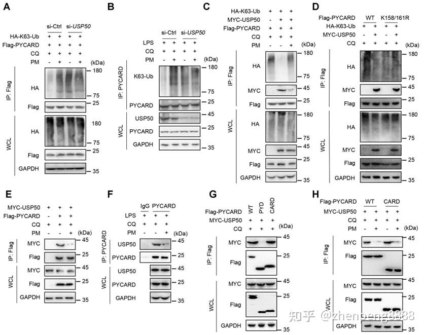 扁蒴藤素通过选择性自噬调节AIM2-PYCARD/ASC的稳定性来抑制AIM2炎症小体缓解肌腱病 - 知乎