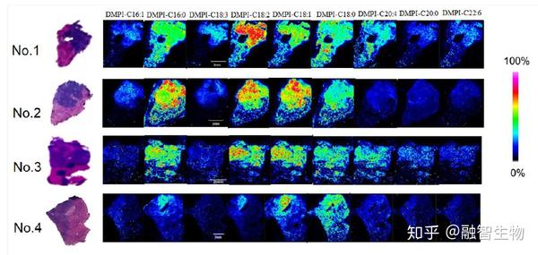 郭寅龙团队：组织中脂肪酸和磷脂同时MALDI质谱成像分析 - 知乎
