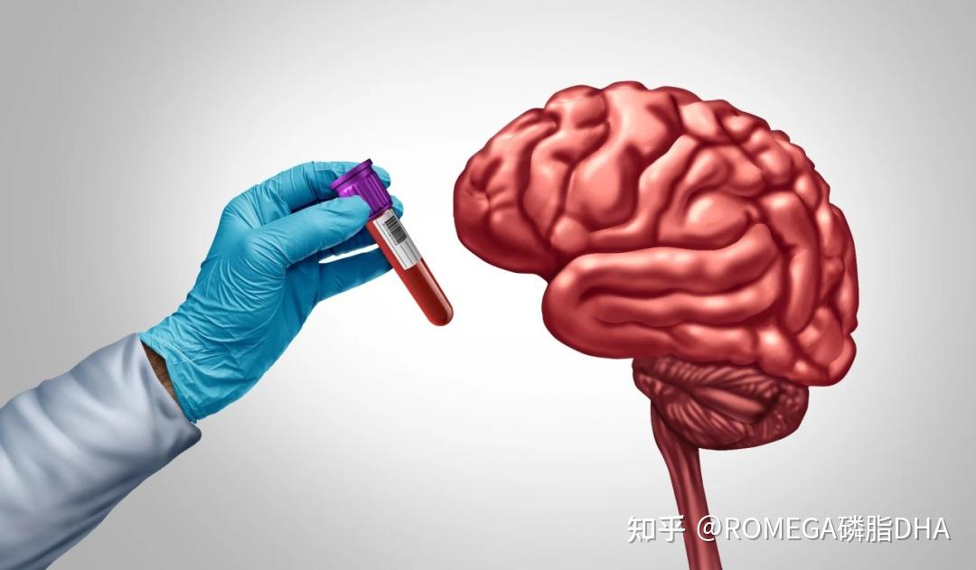 阿尔茨海默症早筛有新突破？血浆P-Tau217或成未来临床检测主流 - 知乎