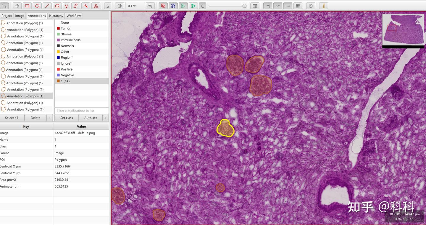 Qupath-export & import json - 知乎