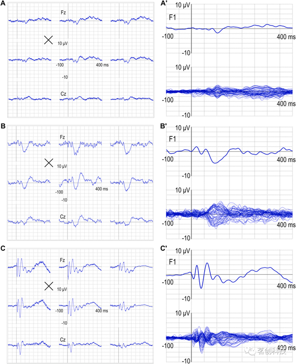 rt-TEP工具：实时显示TMS诱发电位，最大化皮层激活和最小化伪影 - 知乎