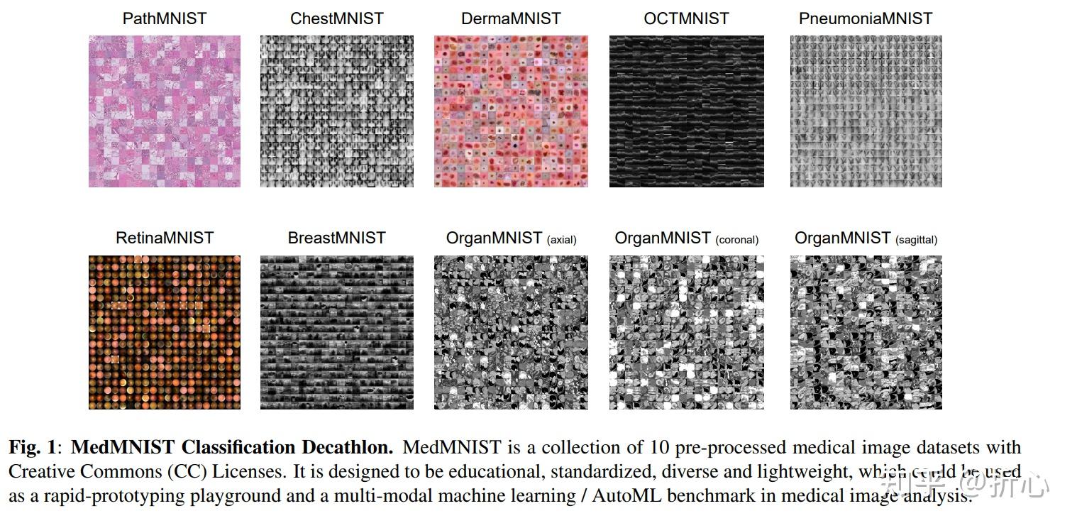 一些文章：MedMNIST - 知乎