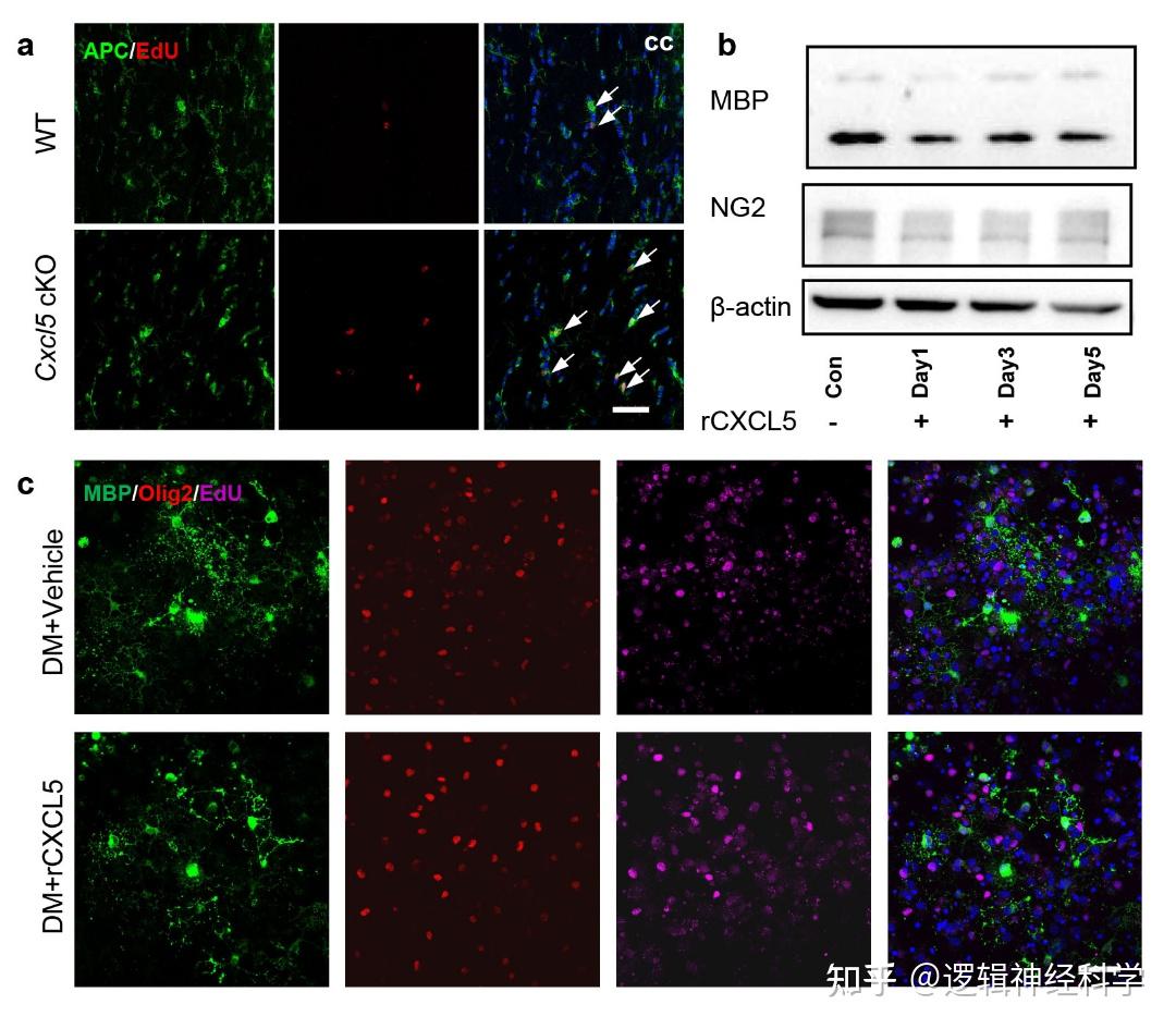 J Neuroinflammation︱南京大学医学院附属鼓楼医院徐运/邱树卫团队揭示星形胶质细胞源性CXCL5在慢性缺血性脑白质损伤中的作用 ...