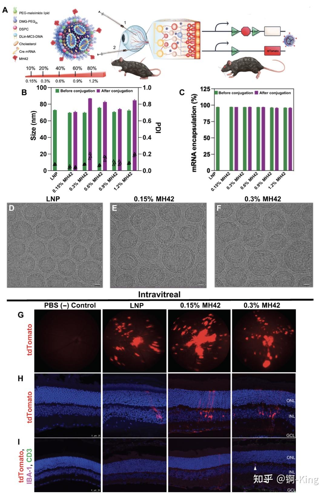 遗传性失明患者新希望！LNP首次成功靶向感光细胞，已在非人灵长类动物中获积极结果 - 知乎