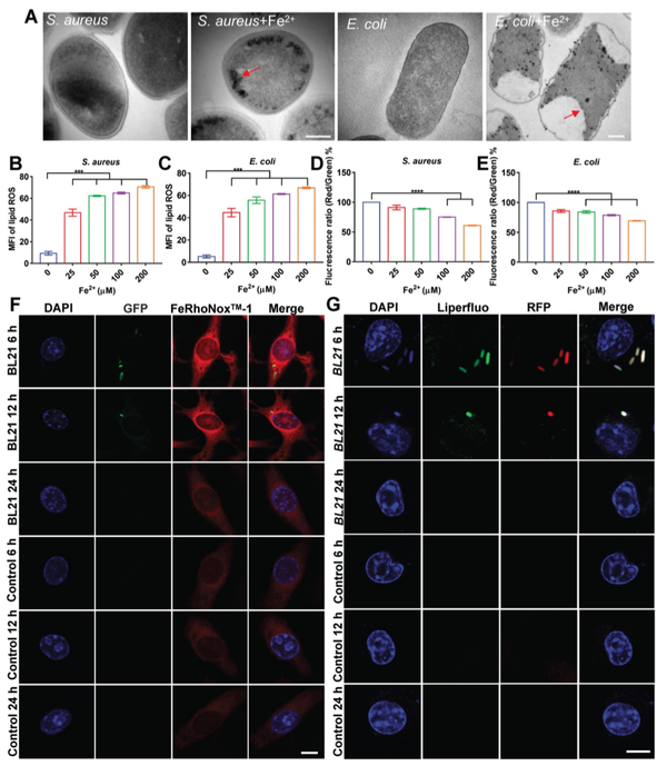 中科院一区TOP Theranostics丨铁死亡的抗菌作用 - 知乎