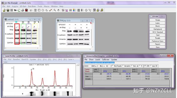 从实验原理吃透Western Blotting - 知乎