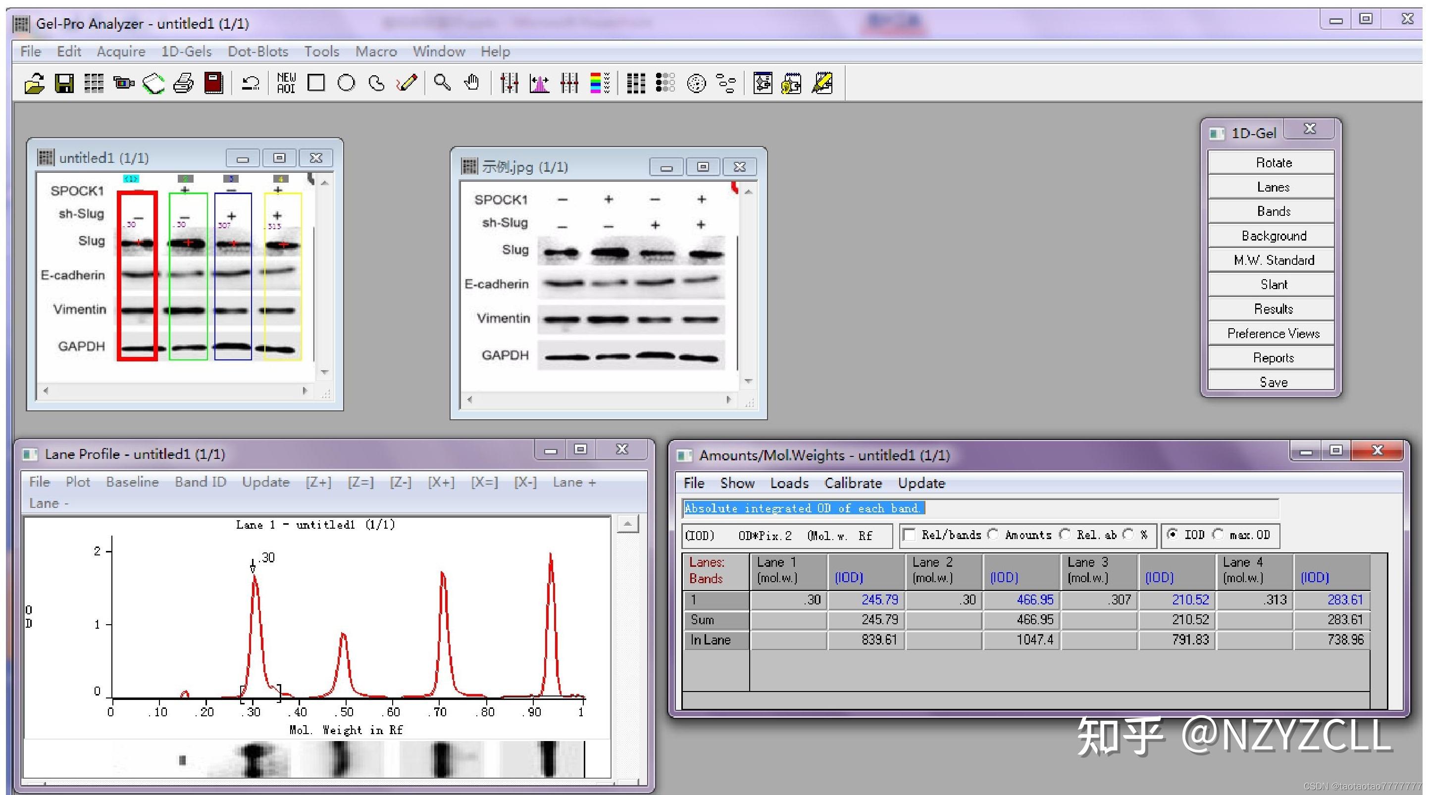 从实验原理吃透Western Blotting - 知乎