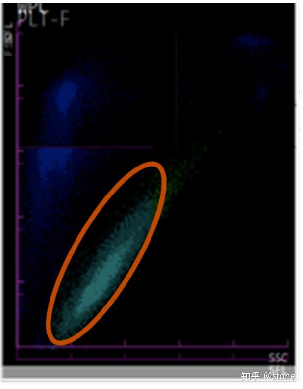 PLT检测-Sysmex血球仪三种不同检测方法 - 知乎