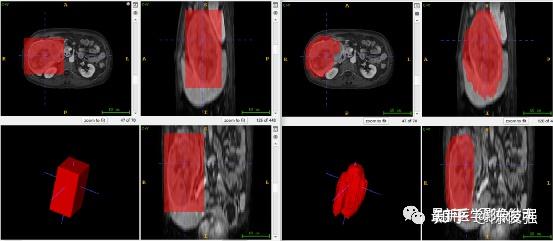 LLD-MMRI2023——多模态MRI 的肝脏病变诊断挑战 - 知乎
