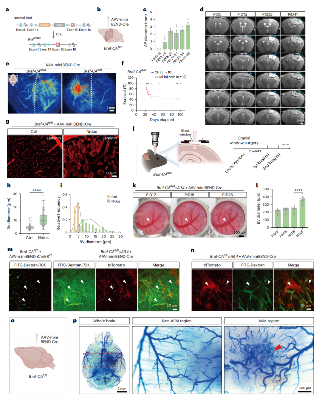 Nat Biomed Eng|戈鹉平/孙文智开发rAAV-miniBEND系统：破解脑内皮细胞基因递送难题，助力脑血管畸形建模！ - 知乎