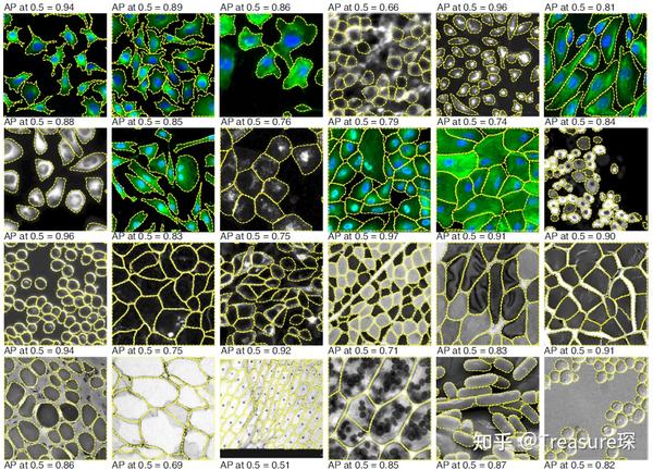 细胞分割神器——Cellpose（安装篇） - 知乎