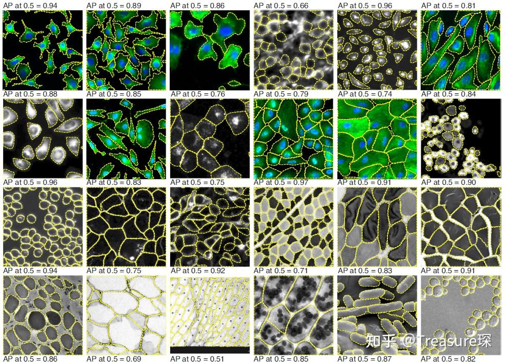 ImageJ实用教程——基于cellpose的不规则细胞分割（案例分析篇） - 知乎
