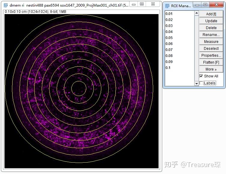 ImageJ实用技巧——径向荧光平均值检测(定量分析篇) - 知乎