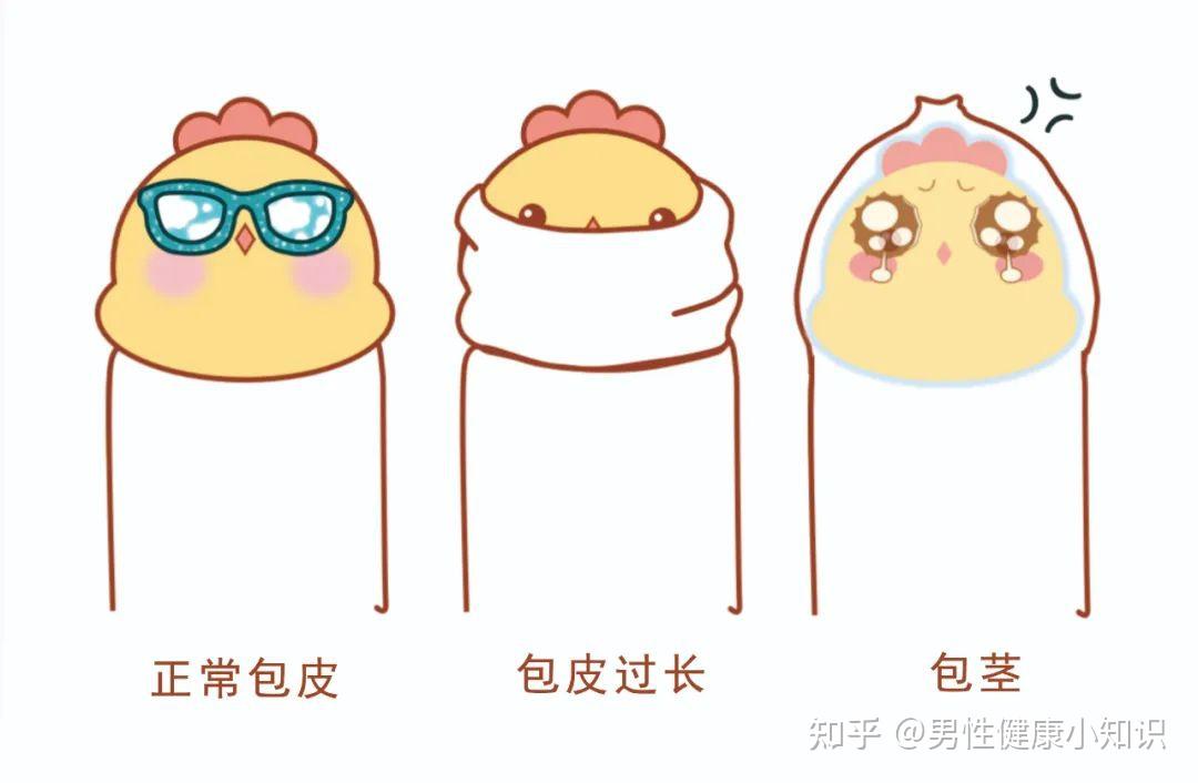株洲九龙男科医院:怎么样的包皮才算长?为什么要割包皮? 知乎