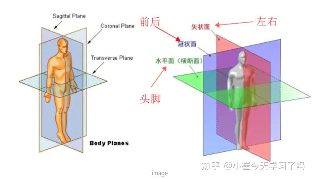 医学图像中横截面、冠状面、矢状面 知乎