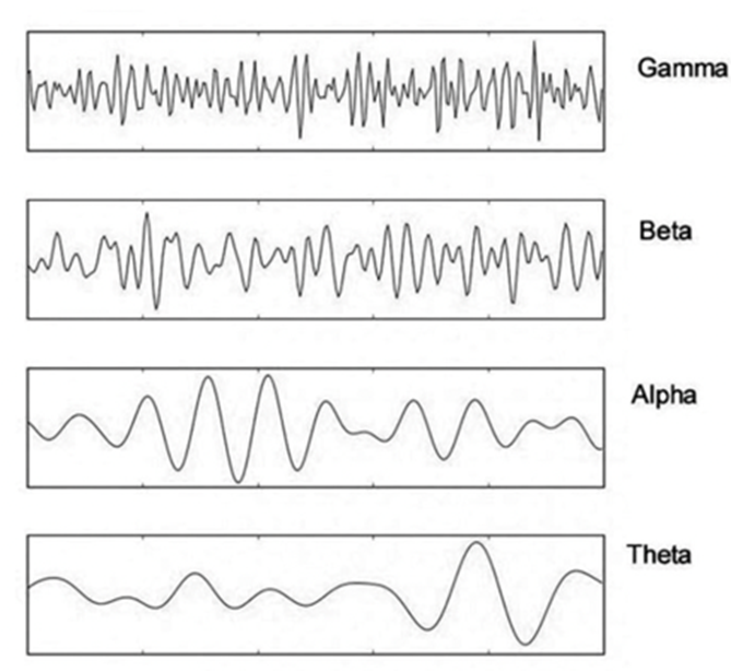 科研｜脑影像技术与方法之EEG基础速览 - 知乎