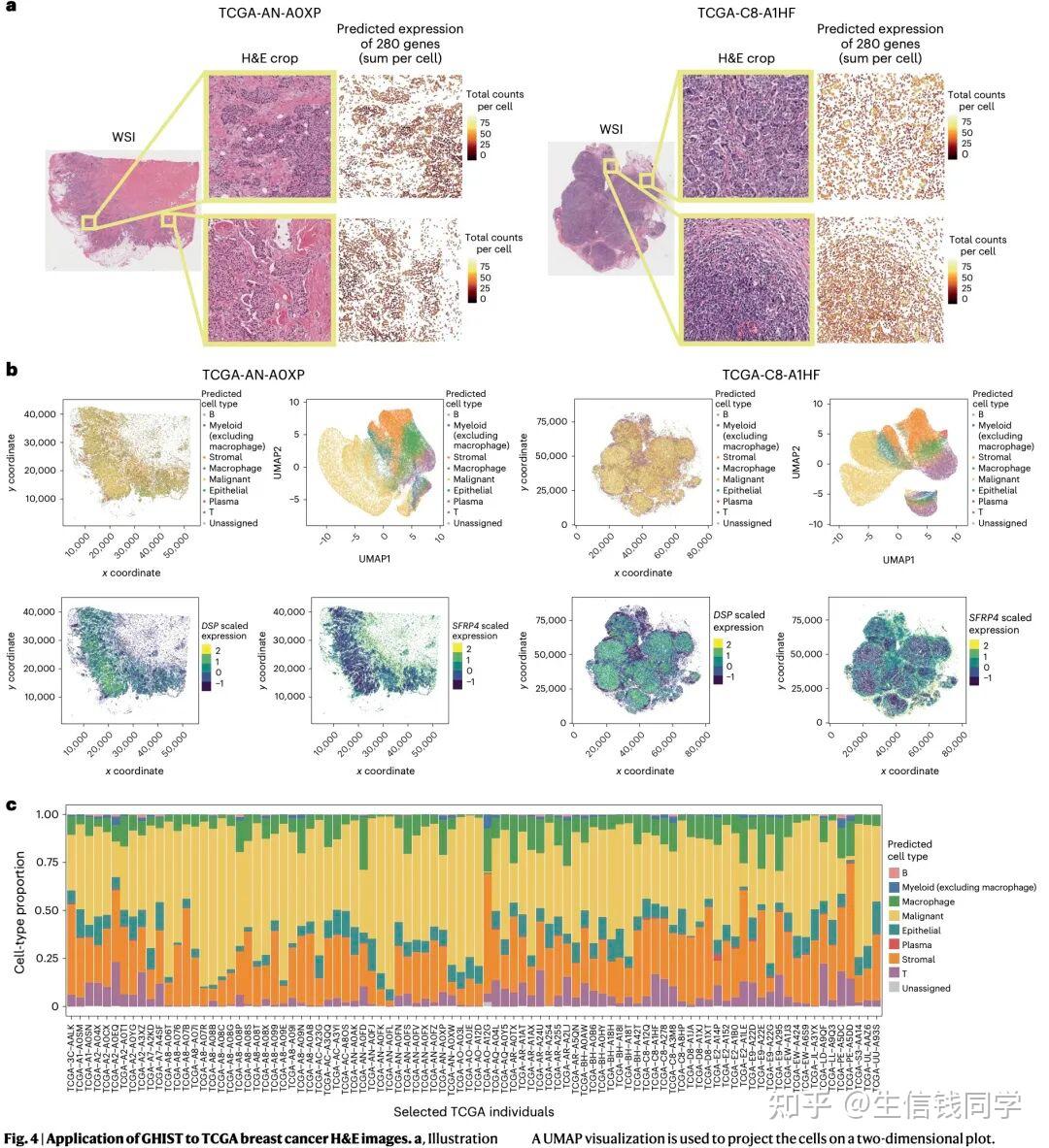Nature Methods ｜省钱省力，GHIST从常规病理图像实现单细胞级基因表达预测 - 知乎