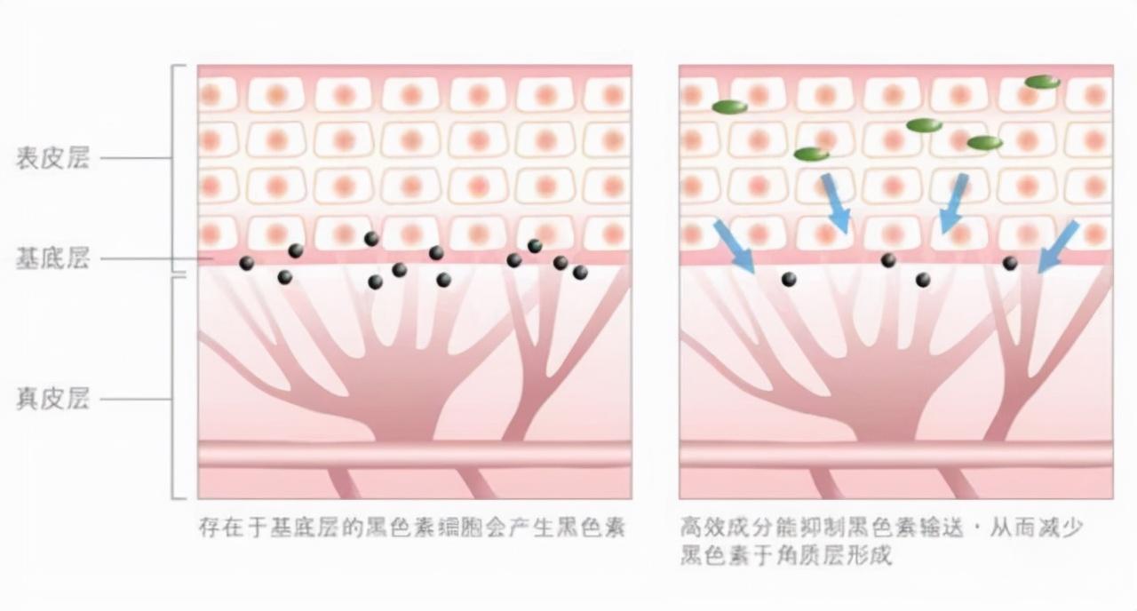 解读美白原理 知乎
