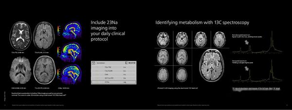 最新！飞利浦磁共振成像系统MR 7700获FDA批准 - 知乎