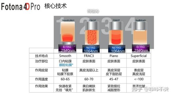 欧洲之星 Fotona4d 原理、功效、价格全揭秘！ - 知乎