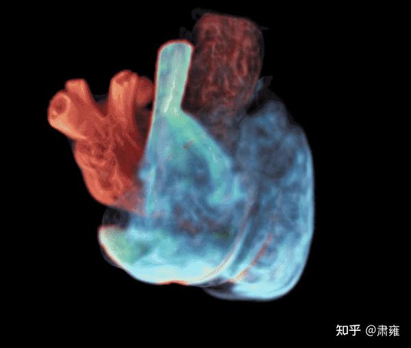数字孪生-心脏领域西门子和living heart project - 知乎