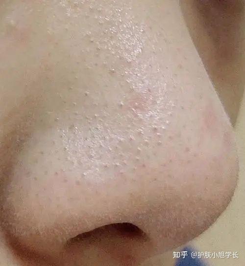 卡粉浮粉怎么办?注意这几点就够了 知乎