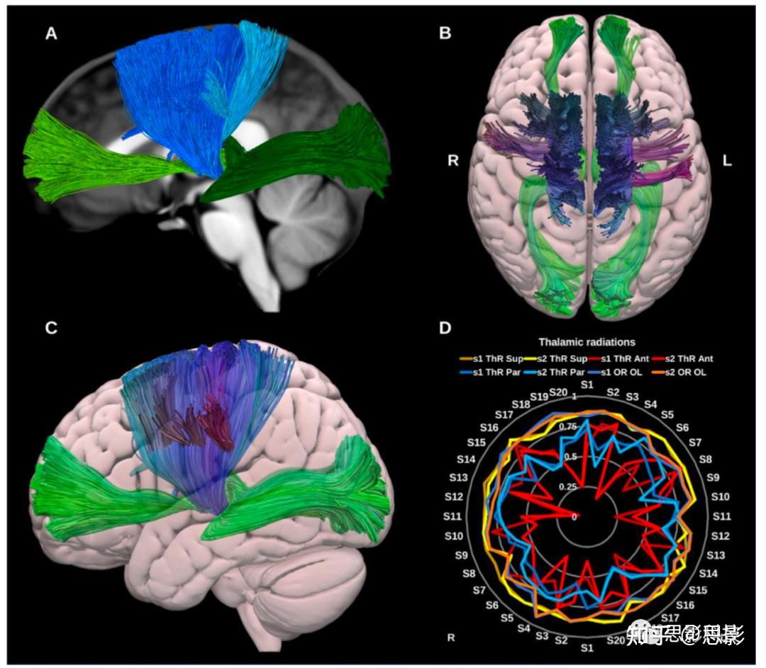 基于约束球面反卷积扩散磁共振的脑白质解剖图谱 - 知乎