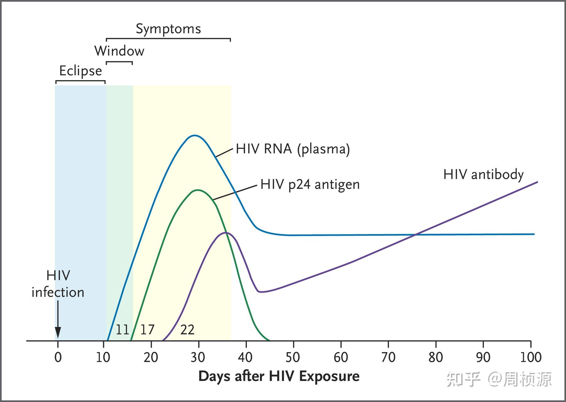 Nejm 2021 Case 24 - 知乎