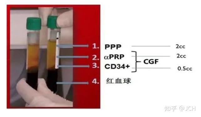 临床上所用的PRP、PRF和CGF都是血液制品，它们的区别在哪里？ - 知乎