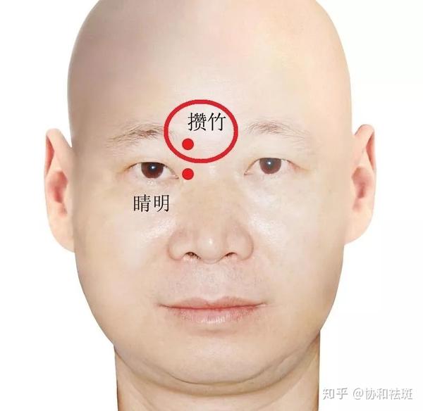 脸上长斑，体内必有瘀！按这4个穴位，气色好的不得了！ 知乎