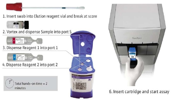 Cepheid公司的GeneXpert芯片检测流程 - 知乎